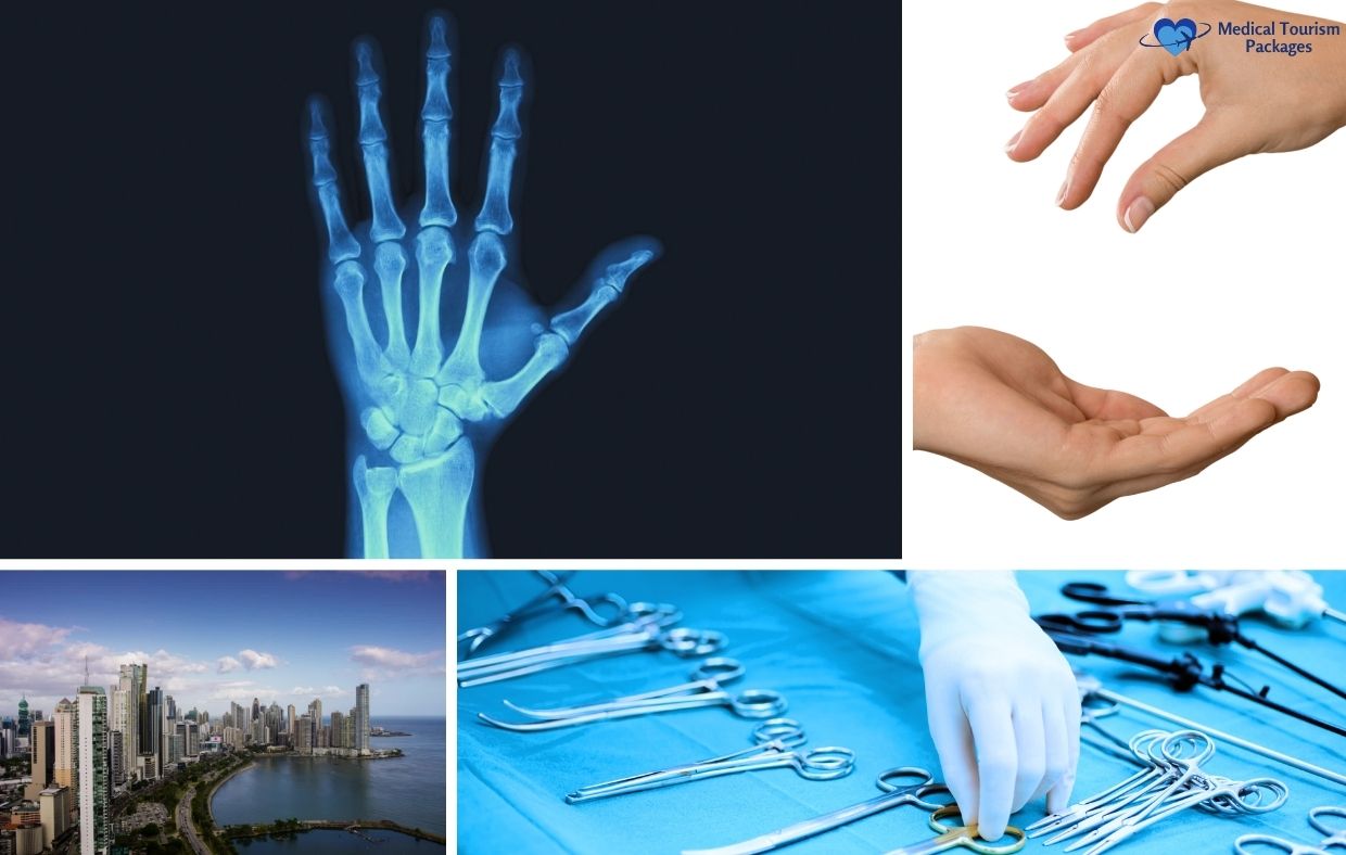 Hand Surgery in Panama - Carpal Tunnel, Trigger Finger, Tendon Repair ...