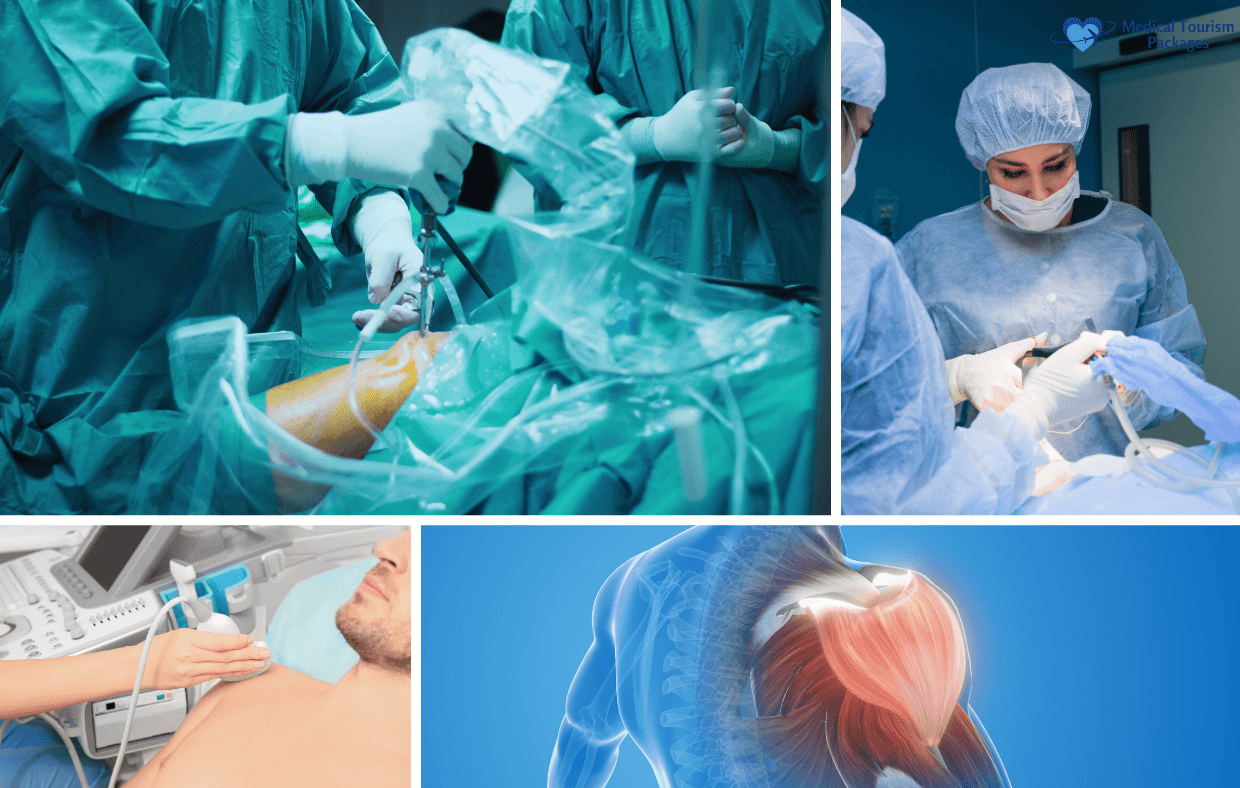 Shoulder Surgery in Colombia – Save 60-80% on Rotator Cuff Repair ...